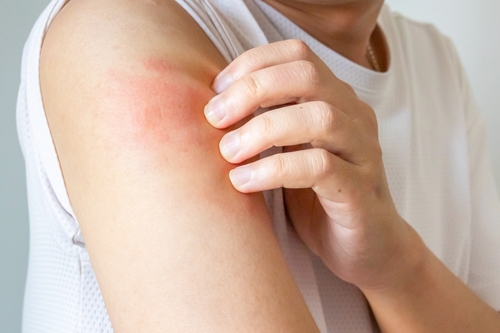 Why Scratching Feels So Good – and What It Really Does to Your Body